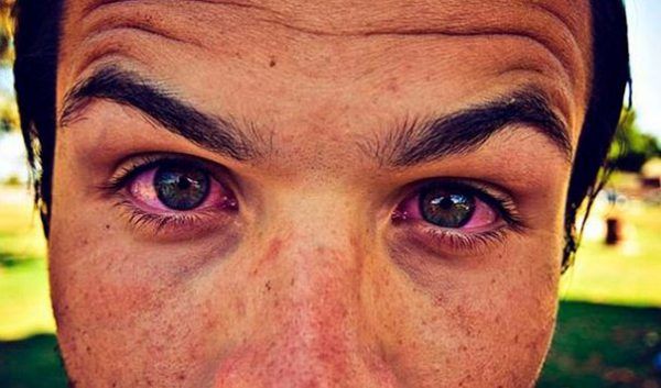 La pálida: ¿Que hacer cuando fumaste de más? | Cosechalibre